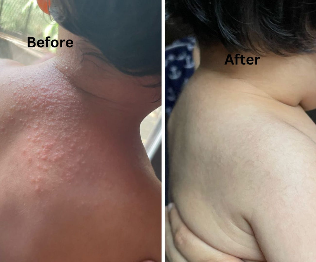 Simply Eden Tallow Skin Transformations – Real Before & After Results